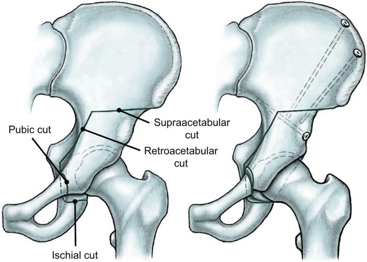 Tigran Garabekyan, M.D., Author at Southern California Hip Institute